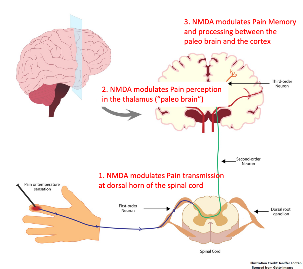Chronic Pain and the Pain Pathway - NRx Pharmaceuticals